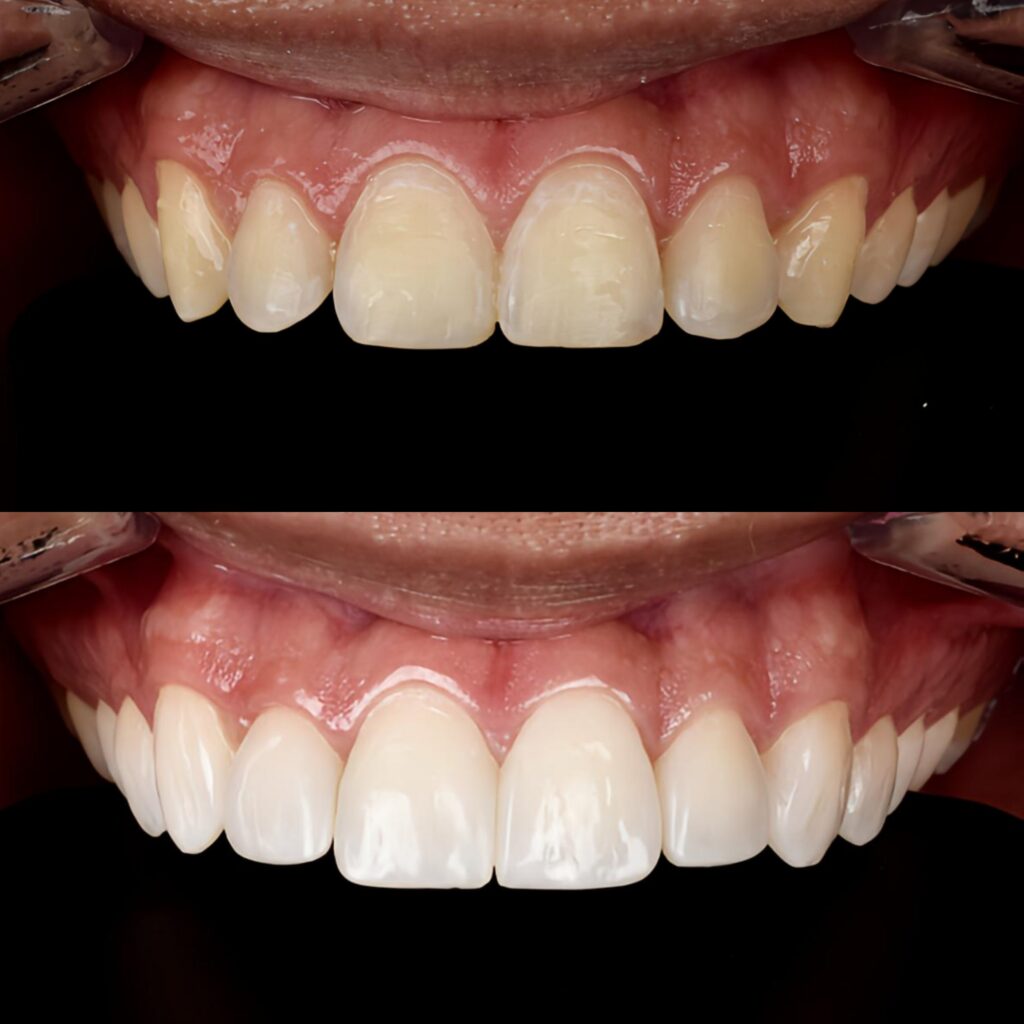 PAQUETES INTERNACIONALES - Dr. Alejandro Martinez