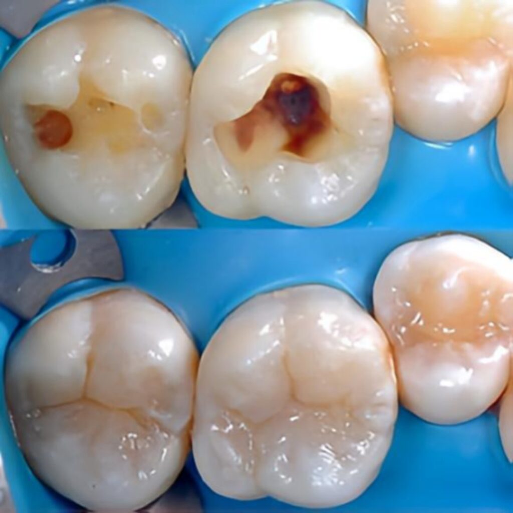 ODONTOLOGÍA RESTAURATIVA - Dr. Alejandro Martinez